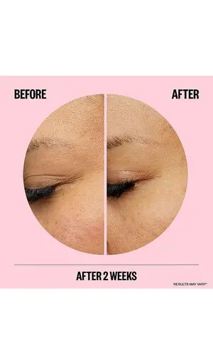 PEACE OUT Microneedling Anti-wrinkle Retinol Patches