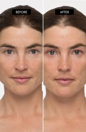 7E WELLNESS Myolift Triwave Advanced Microcurrent Facial Device - None