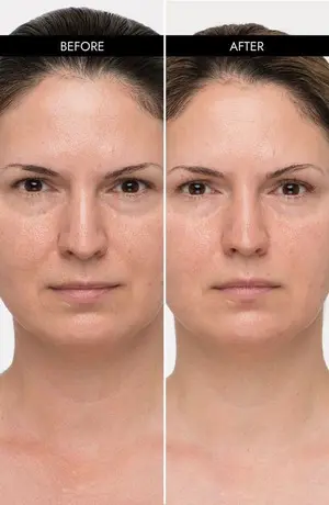 7E WELLNESS Myolift Mini Microcurrent Facial Toning Device - None
