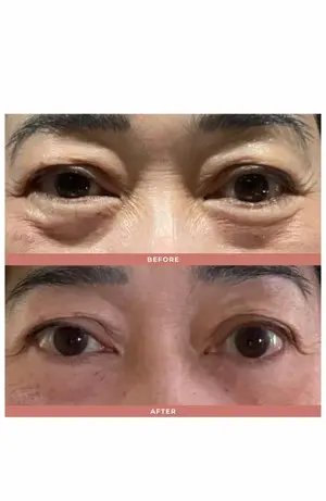 OLIVIA QUIDO SKINCARE Wrinkle Blur Eye Brightener