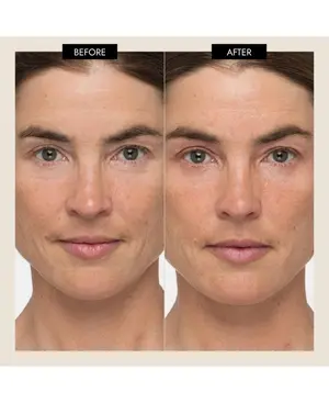 7E WELLNESS Myolift Triwave Microcurrent Facial Device - White