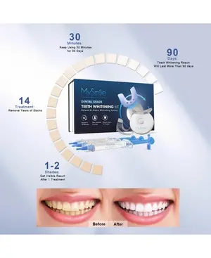 MYSMILE Teeth Whitening Kit With Led Light