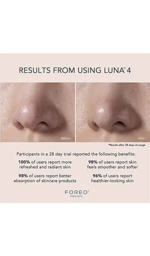 Foreo Luna 4 Facial Cleansing & Firming Device For Balanced Skin - N,a