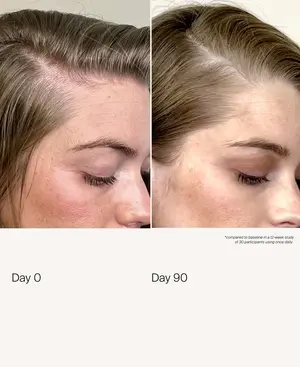 Living Proof Scalp Care Density Serum