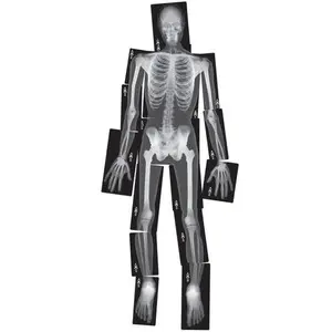 ROYLCO Human X-rays On Film
