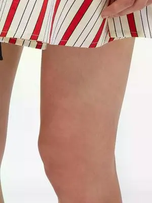 MSGM Striped Mini Dress