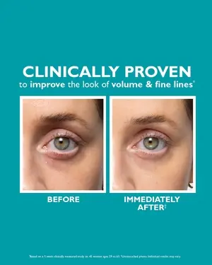PETER THOMAS ROTH Peptide Skinjection Fill + Fix Under Eye Cream 0.5 Oz