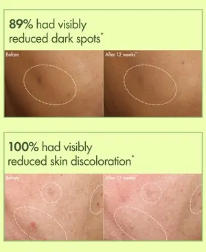 ORIGINS Mega-mushroom Dark Spot Brightening Serum