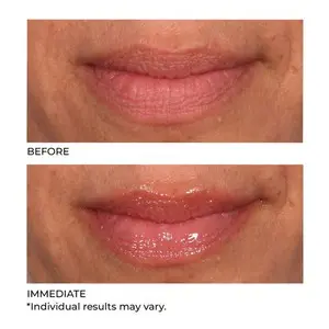 DR. NASSIF SKINCARE Hydro-screen For Lips - Pink Champagne