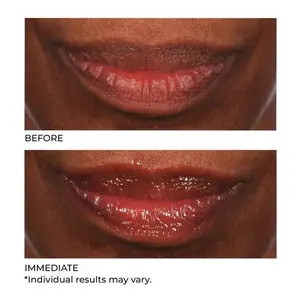 DR. NASSIF SKINCARE Hydro-screen For Lips - Pink Champagne