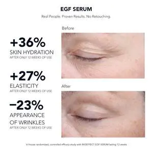 BIOEFFECT Egf Serum  15ml