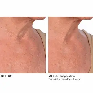 DR. NASSIF SKINCARE Hydro-screen Souffle