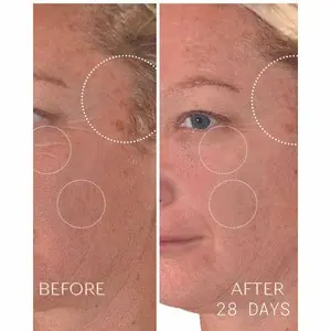 YON-KA Serum C2020% Vitamin C Anti-aging And Bright Serum 0.17oz - None