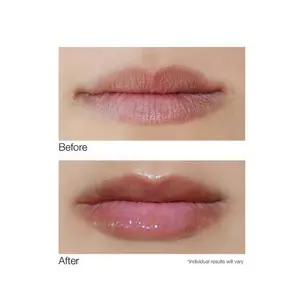DERMELECT Smooth Lip Volumizer - Clear