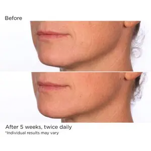 DR. NASSIF SKINCARE Hydro-screen Serum - 4oz