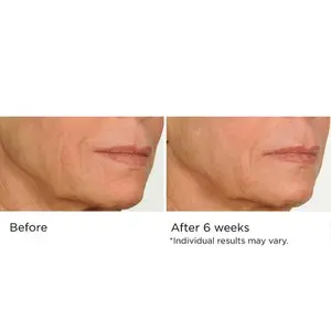 DR. NASSIF SKINCARE Night Therapy Serum 1oz