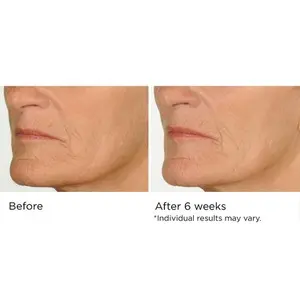 DR. NASSIF SKINCARE Night Therapy Serum 1oz