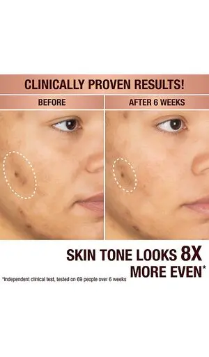 Charlotte Tilbury Dark Spot Correcting Radiance Recovery Serum 10ml