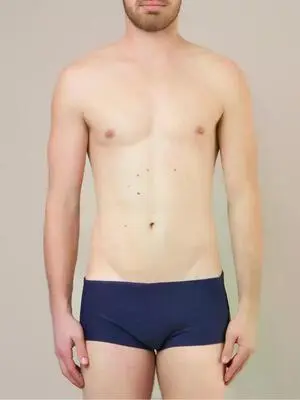 AMIR SLAMA Swimming Trunks