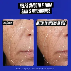 KIEHL'S SINCE 1851 Midnight Recovery Concentrate Moisturizing Face Oil - One-color