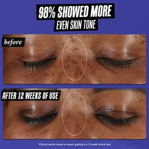 KIEHL'S SINCE 1851 Clearly Corrective™ Clarify & Brighten Dark Spot Serum - One-color
