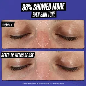 KIEHL'S SINCE 1851 Clearly Corrective™ Clarify & Brighten Dark Spot Serum - One-color