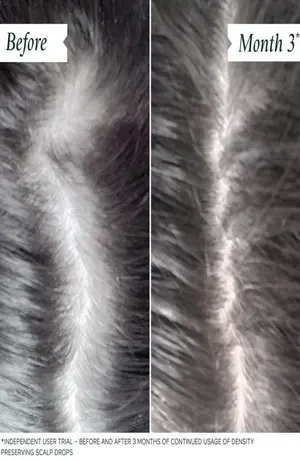 PHILIP KINGSLEY Density Preserving Scalp Drops - No Color