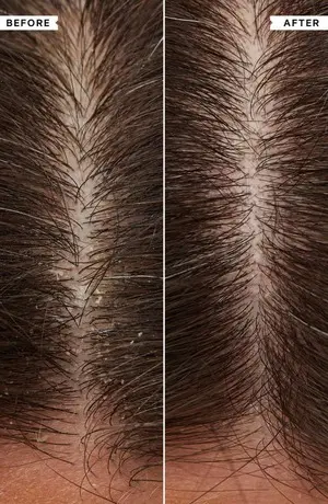 PHILIP KINGSLEY Flaky Scalp Hydrating Conditioner