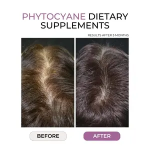 PHYTO Cyane Dietary Supplement