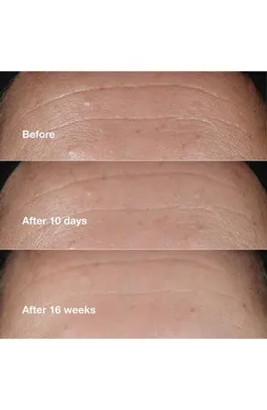 CLINIQUE Jumbo Clinical Repair Wrinkle Correcting Serum $192 Value