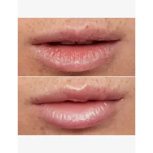 WONDERSKIN Lip Rehab Serum Oil 3.57ml - Clear