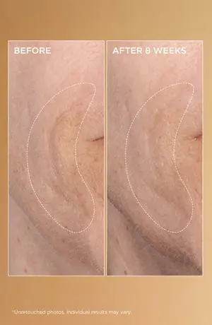 PERRICONE MD Neuropeptide Rejuvenating Moisturizer Broad Spectrum Spf 25