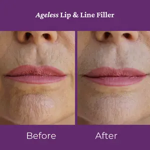PRAI BEAUTY Ageless Lip Line Filler 8ml