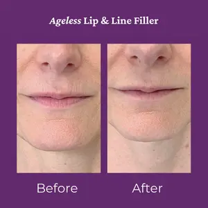 PRAI BEAUTY Ageless Lip Line Filler 8ml