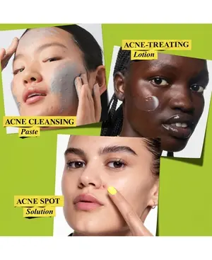 KIEHL'S SINCE 1851 3-pc. Clear Intentions Cleansing Paste And Spot Treatment Set