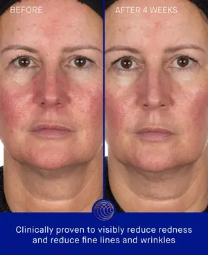 Augustinus Bader The Hydrogel Face Mask