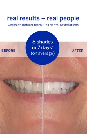 SUPERSMILE Superstrips Dissolving Strips Box Of 14 - White