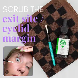 WE LOVE EYES Mgd & Chalazion Systemno Tea Tree Oil