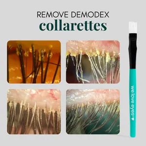 WE LOVE EYES Demodex Mites Debris Cleansing System