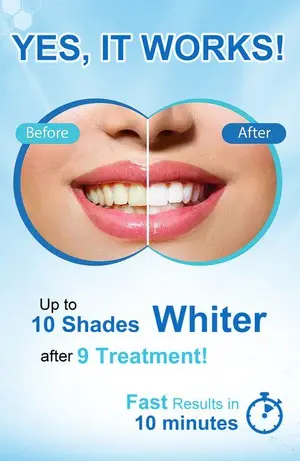 MYSMILE Teeth Whitening Pen Kit 14 Treatmentsnon-sensitive Teeth Whitening Gel Pen
