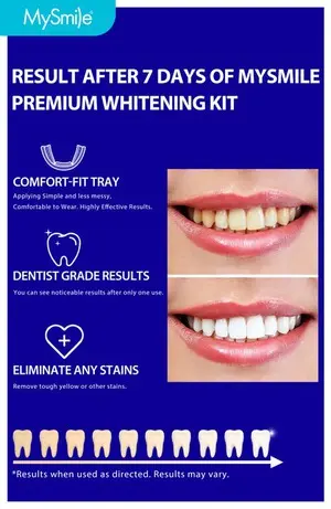 MYSMILE Prefilled Teeth Whitening Trays Kit