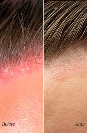 MONPURE Clarifying Scalp Scrub 90g