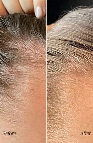 MONPURE Follicle Boost Hair Density Serum 50ml