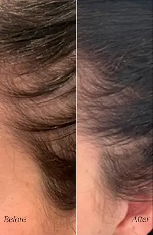 MONPURE Nourish And Stimulate Scalp Mask 100g