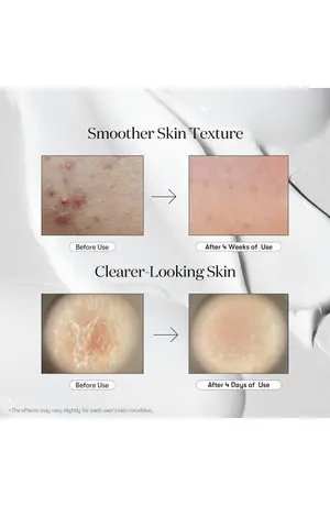 VT COSMETICS Reedle Shot™ 700 - Silver