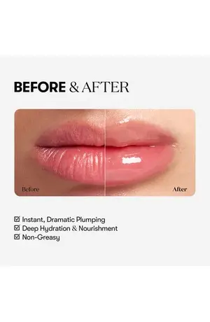 VT COSMETICS Reedle Shot Lip Plumper Expert - Silver
