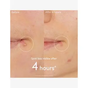 CAUDALIE Vinopure Acid Salicylic Spot Solution