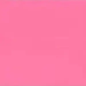 Kurt Geiger Maddison T-bar Sandals - Pink