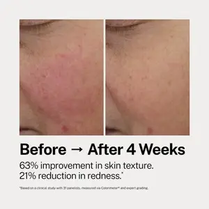DR ROSSI DERM MD The Catalyst Renewing Serum - 30ml