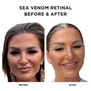 INTOXICATED COSMETICS Sea Venom Retinal | 1fl.oz/30ml | Anti-aging Time Released Retinaldehyde | Regenerating Sensamone P5 | Restructuring